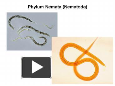 PPT – Phylum Nemata Nematoda PowerPoint presentation | free to view - id: 120499-YmZhN