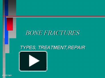 BONE FRACTURES presentation | free to view