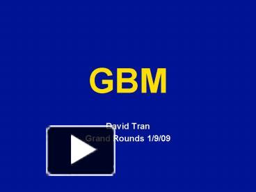 GBM presentation | free to view