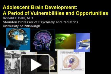 Adolescent Brain Development: A Period of Vulnerabilities and Opportunities Ronald E Dahl, M'D ...
