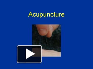 Acupuncture presentation | free to view