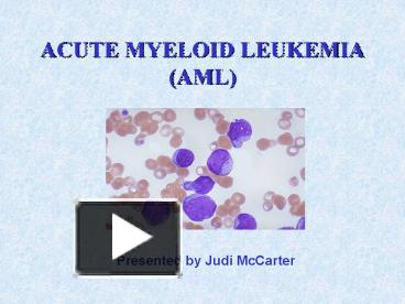 ACUTE MYELOID LEUKEMIA AML presentation | free to view