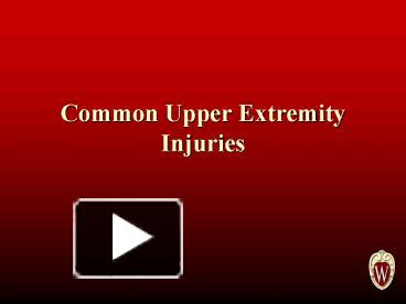 Common Upper Extremity Injuries presentation | free to view