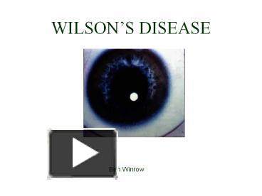 WILSON presentation | free to download