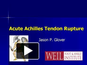 Acute Achilles Tendon Rupture presentation | free to view