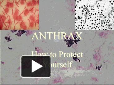 PPT – ANTHRAX PowerPoint presentation | free to view - id: 1cd0fd-ZDc1Z