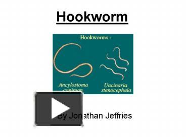 Hookworm presentation | free to view