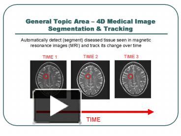 General Topic Area 4D Medical Image Segmentation presentation | free to view