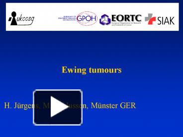 PPT – Ewing tumours PowerPoint presentation | free to download - id: 205535-ZDc1Z
