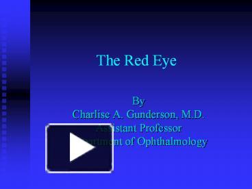 The Red Eye presentation | free to view