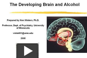 The Developing Brain and Alcohol presentation | free to view