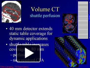 PPT – Volume CT shuttle perfusion PowerPoint presentation | free to view - id: 25d70b-ZDc1Z