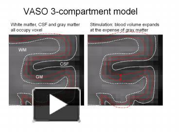 PPT – VASO 3compartment model PowerPoint presentation | free to download - id: 271df2-YjE4O