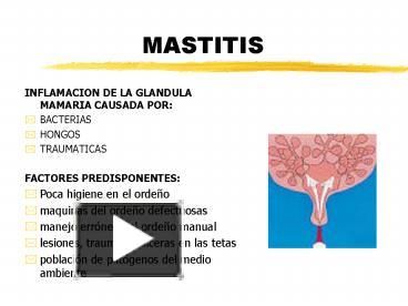 MASTITIS presentation | free to view