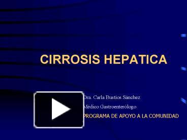 CIRROSIS HEPATICA presentation | free to view
