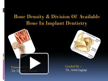 bone density seminar presentation | free to download