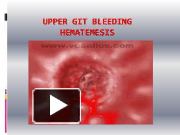 UPPER GIT BLEEDING HEMATEMESIS presentation | free to view