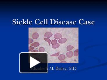 PPT – Sickle Cell Disease Case PowerPoint presentation | free to view ...