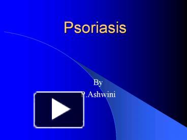 psoriasis presentation | free to download