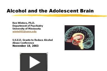 Alcohol and the Adolescent Brain presentation | free to download
