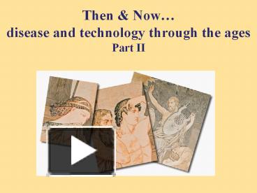 PPT – Then & Now… disease and technology through the ages Part II ...