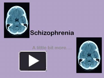 PPT – Schizophrenia PowerPoint presentation | free to download - id ...