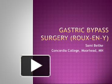 Gastric Bypass surgery (roux-en-y) presentation | free to view