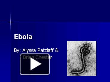 Ebola presentation | free to view