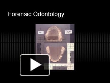 Forensic Odontology presentation | free to download