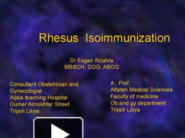 Rhesus Isoimmunization presentation | free to view