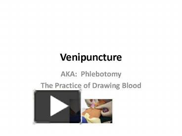 Venipuncture presentation | free to view