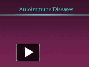 Autoimmune Diseases presentation | free to view