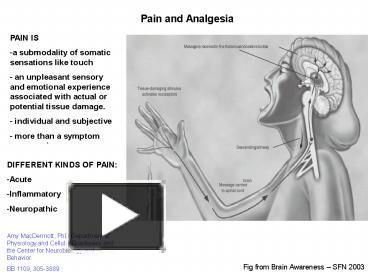Pain and Analgesia presentation | free to download