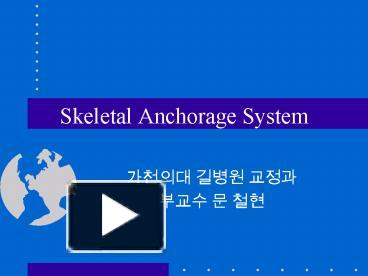 Skeletal Anchorage System presentation | free to view
