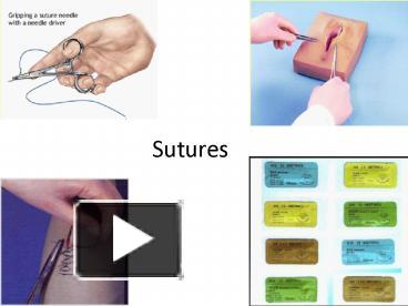 Sutures presentation | free to view