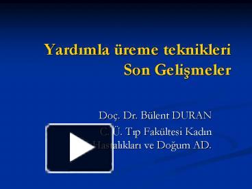 PPT – Yardimla PowerPoint presentation | free to view - id: 49a7f3-ODBlM
