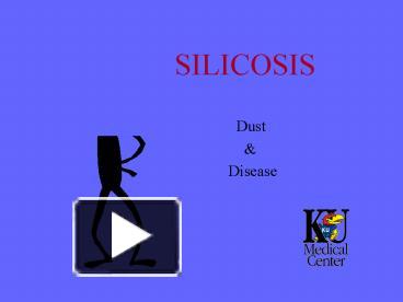 SILICOSIS presentation | free to view
