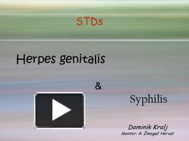 PPT – STDs Herpes genitalis PowerPoint presentation | free to view - id: 54c00f-MDgwM