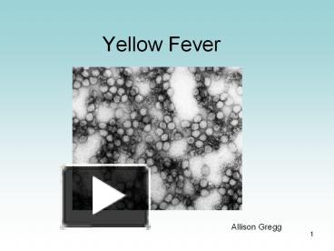 Yellow Fever presentation | free to download