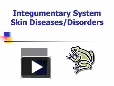 PPT – Integumentary System Skin Diseases/Disorders PowerPoint ...
