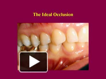 The Ideal Occlusion presentation | free to view