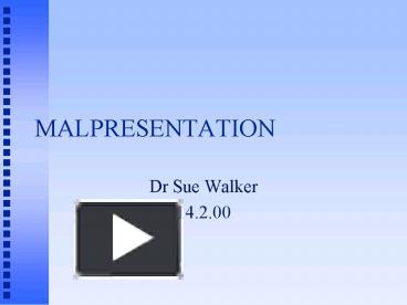 MALPRESENTATION presentation | free to view
