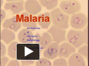 Malaria presentation | free to view
