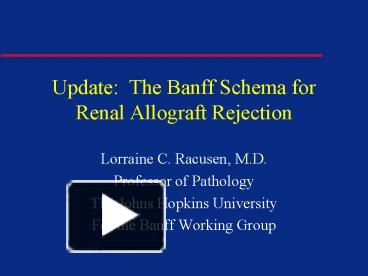 Update: The Banff Schema for Renal Allograft Rejection presentation | free to view
