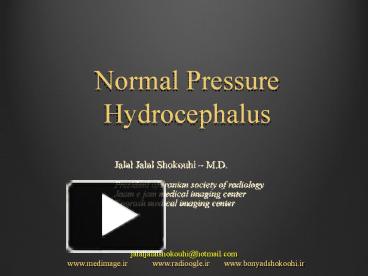 Normal Pressure Hydrocephalus presentation | free to download