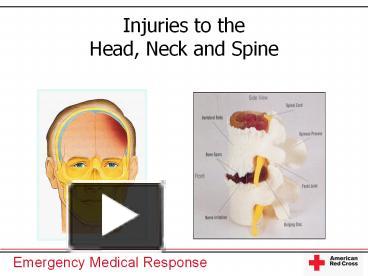 PPT – Injuries to the Head, Neck and Spine PowerPoint presentation ...