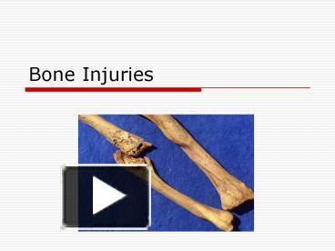 PPT – Bone Injuries PowerPoint presentation | free to view - id: 76664f ...