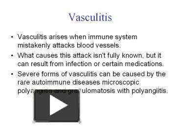 Vasculitis presentation | free to download