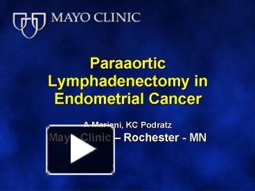 PPT – Paraaortic Lymphadenectomy in Endometrial Cancer PowerPoint presentation | free to view ...