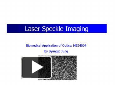 Laser Speckle Imaging presentation | free to view